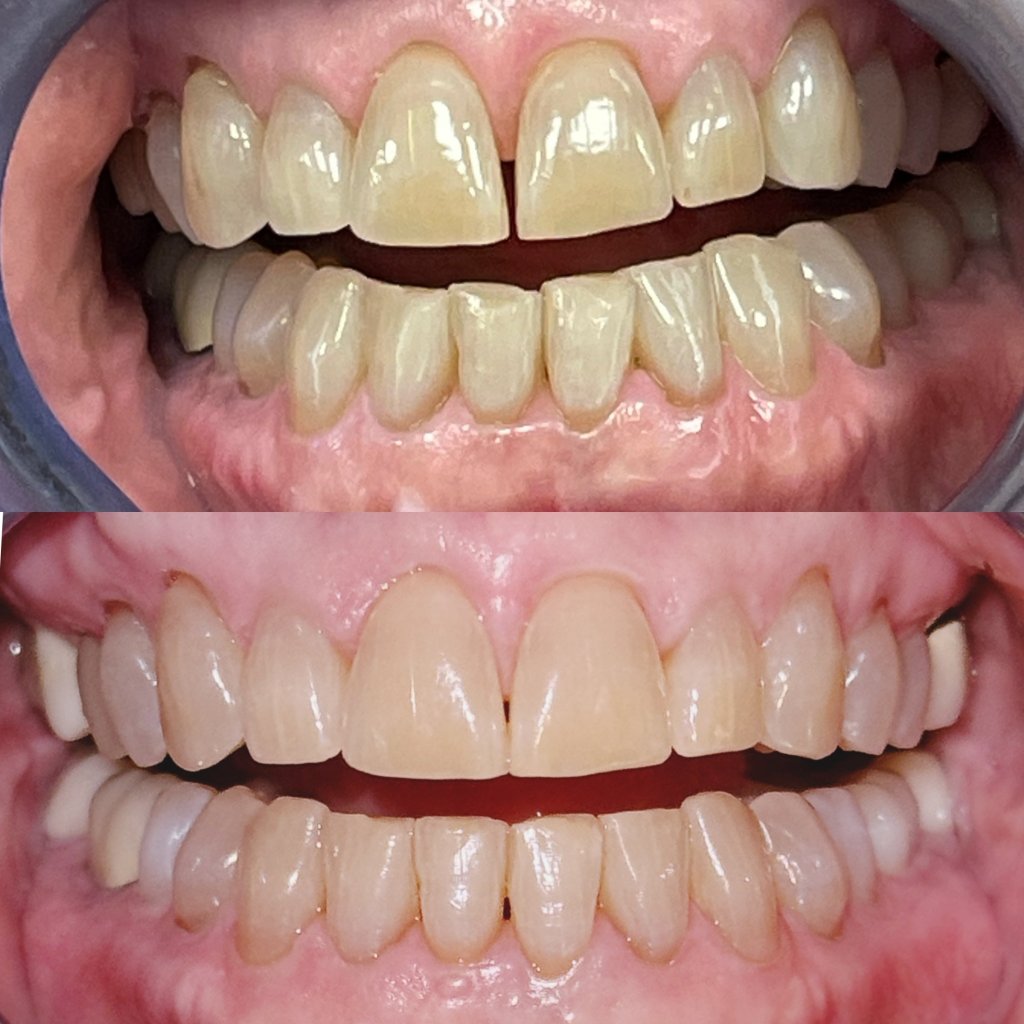 Smile Gallery Noah Dehlinger, DDS, San Anselmo CA
